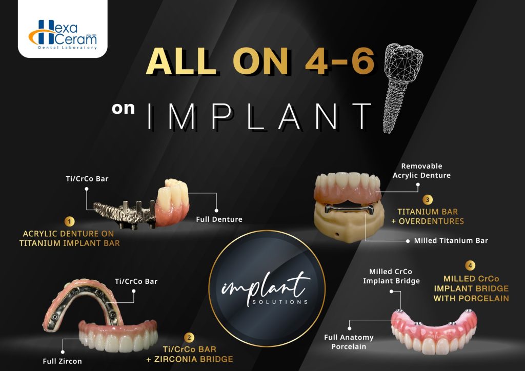 All on 4-6 - hexadentallab