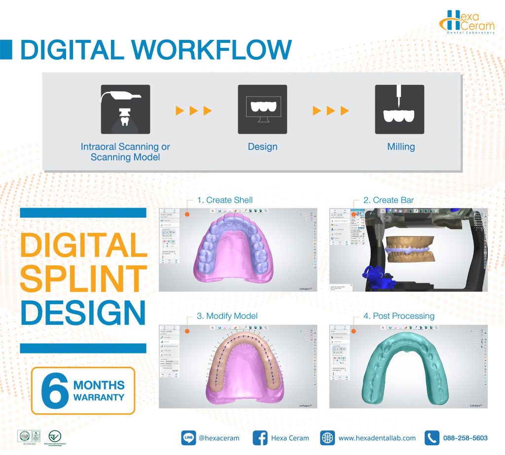Digital Splint - hexadentallab